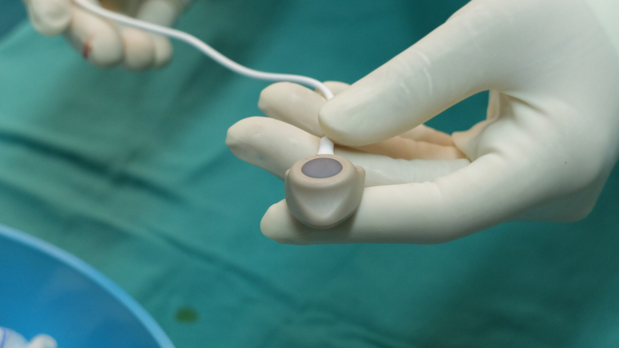 Bard Power Port Lawsuit (April 2025 Update) | Dolman Law Group