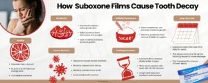 Suboxone Tooth Decay Lawsuit: March 2025 Update